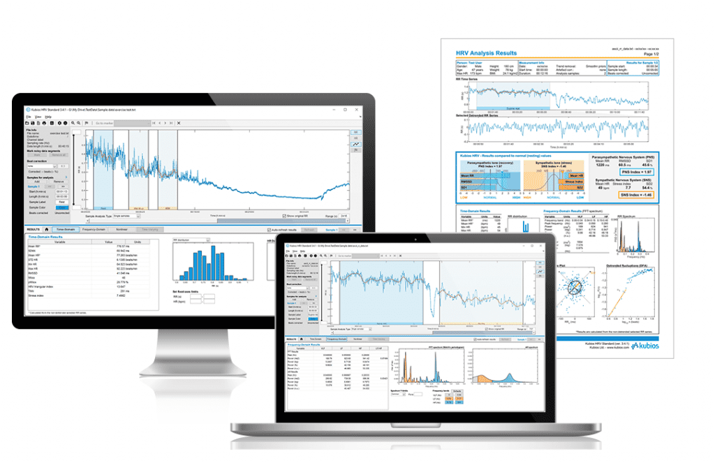 Kubios HRV Standard – Kubios