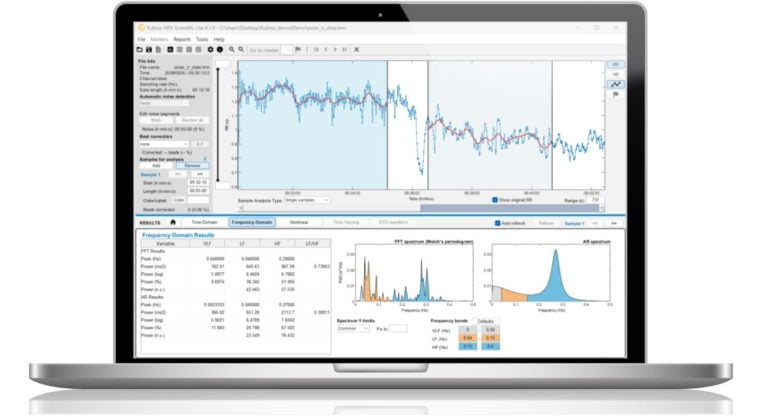 Heart rate variability software - Kubios HRV