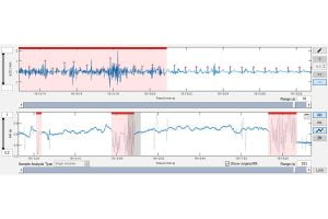 Heart Rate Variability (HRV) Blog - All about HRV